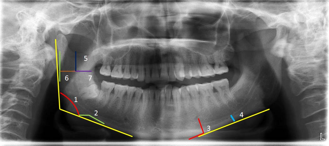 Statistical Analysis