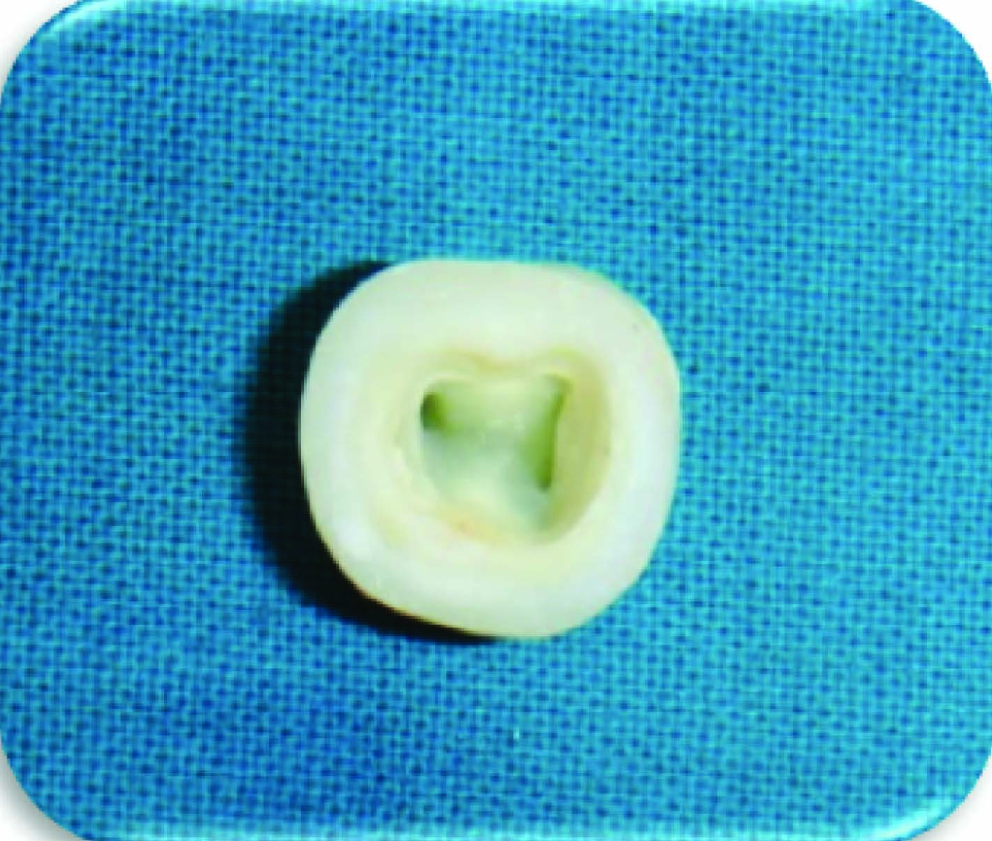 Access cavity prepartion