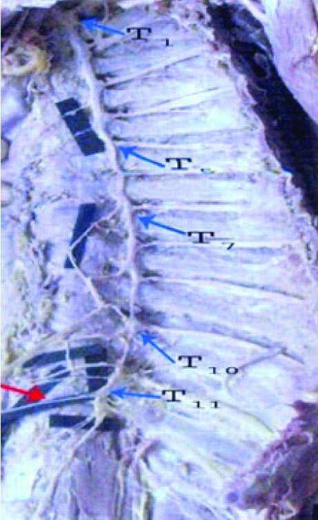 Sympathetic Trunk Ganglion