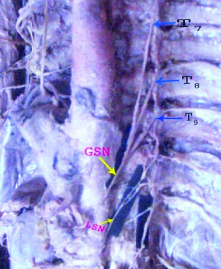 Spinal Cord Nerves Cadaver