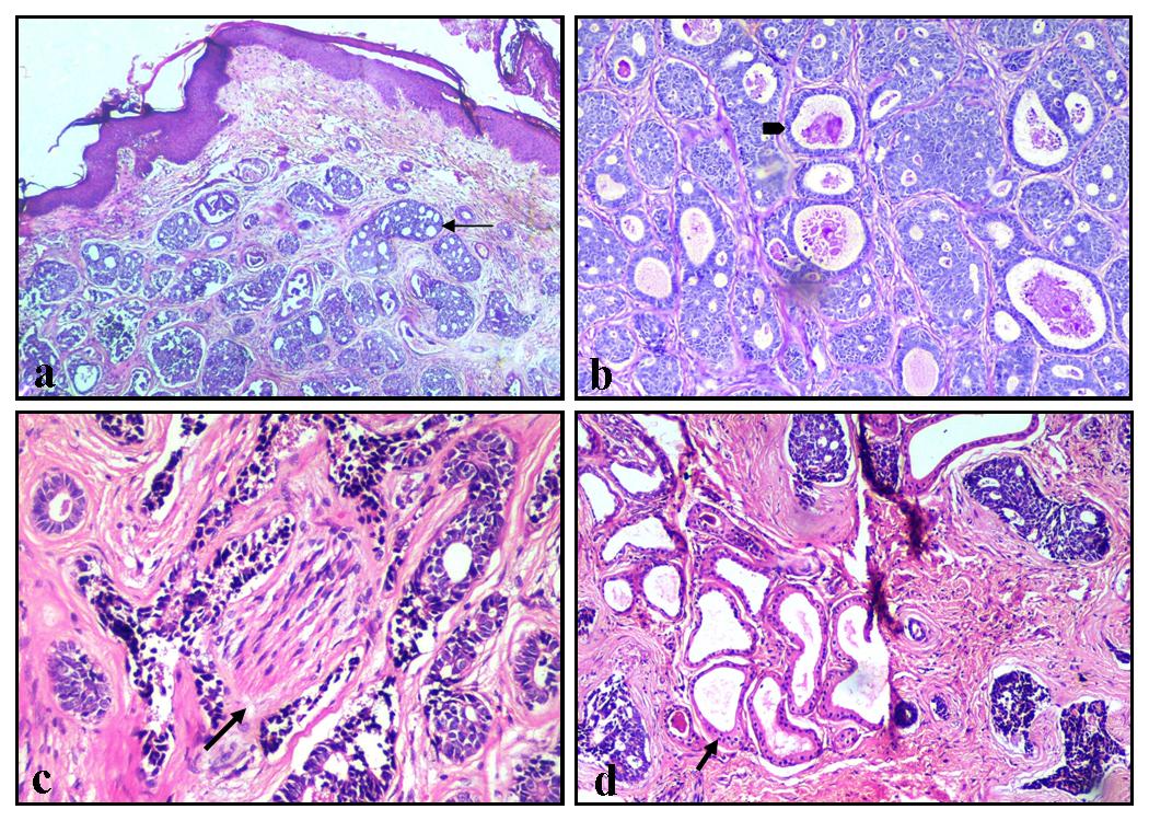 Ceruminous Glands Histology