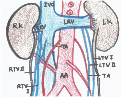 Veia Gonadal Grátis: 2 Anatomia Funcional E Cirurgica Do Sistema
