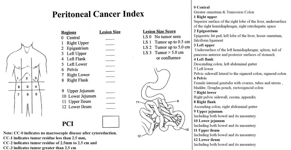 PCI and Completeness of cytoreduction score described by Sugarbaker [ 3 ]