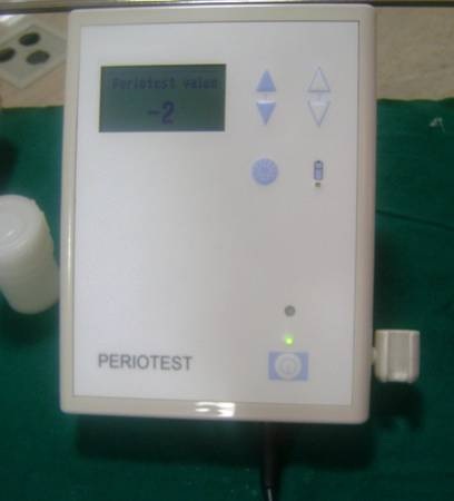 Showing the PT Value using PERIOTEST