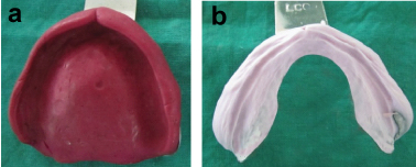 Record Base Fabrication and its modification