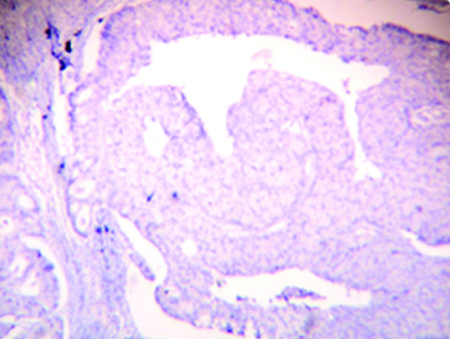 Section shows Negative Batch control human colon carcinoma (IHC-20X)
