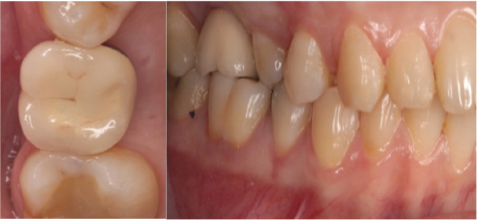Postoperative radiogragh.