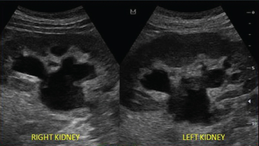 The problem list of patient includes-