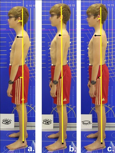 Plumb Line Posture
