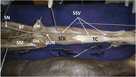 Great Saphenous Vein Cadaver