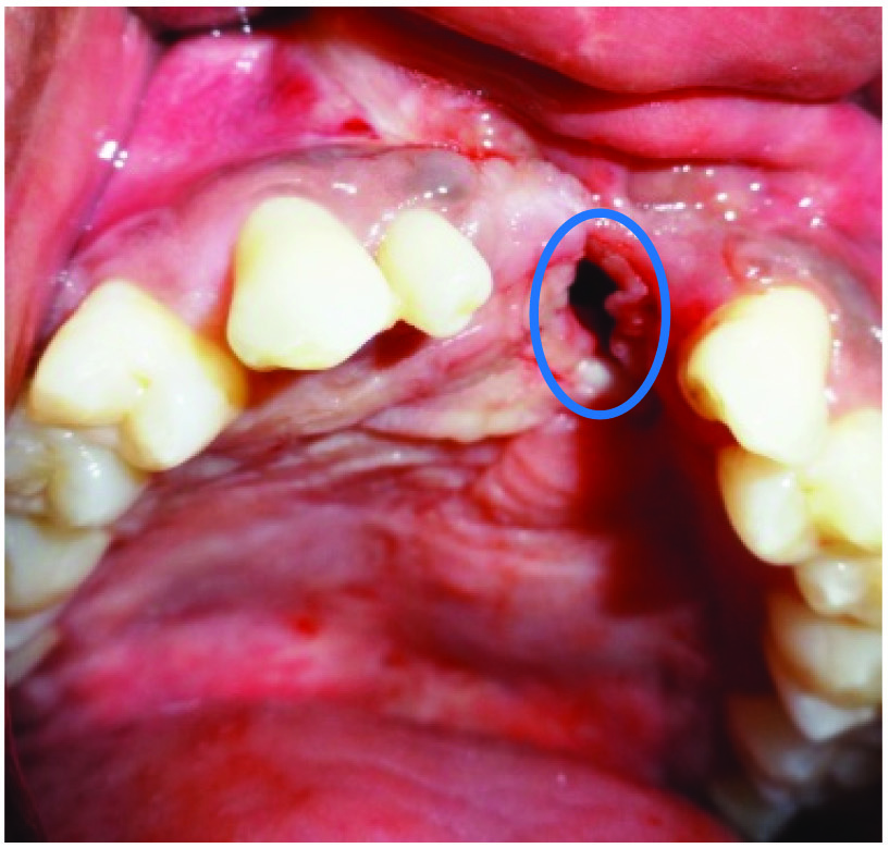 Dog Oral Fistula at Karen Medina blog