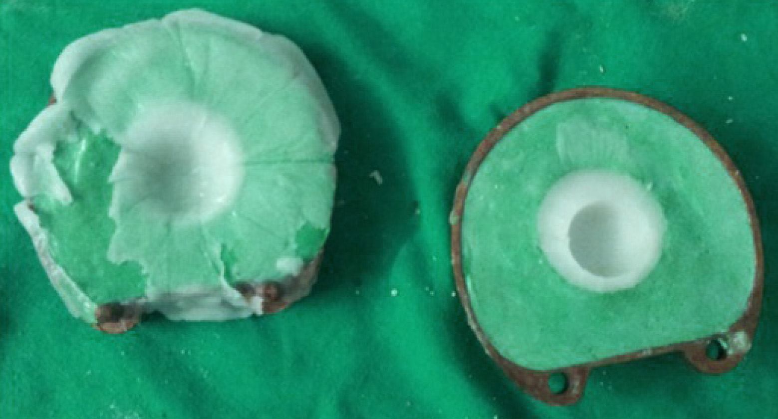 Uniform inner mold space created by suspended elastomeric ball.