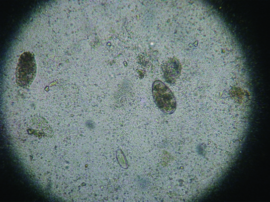 Normal saline mount of stool.