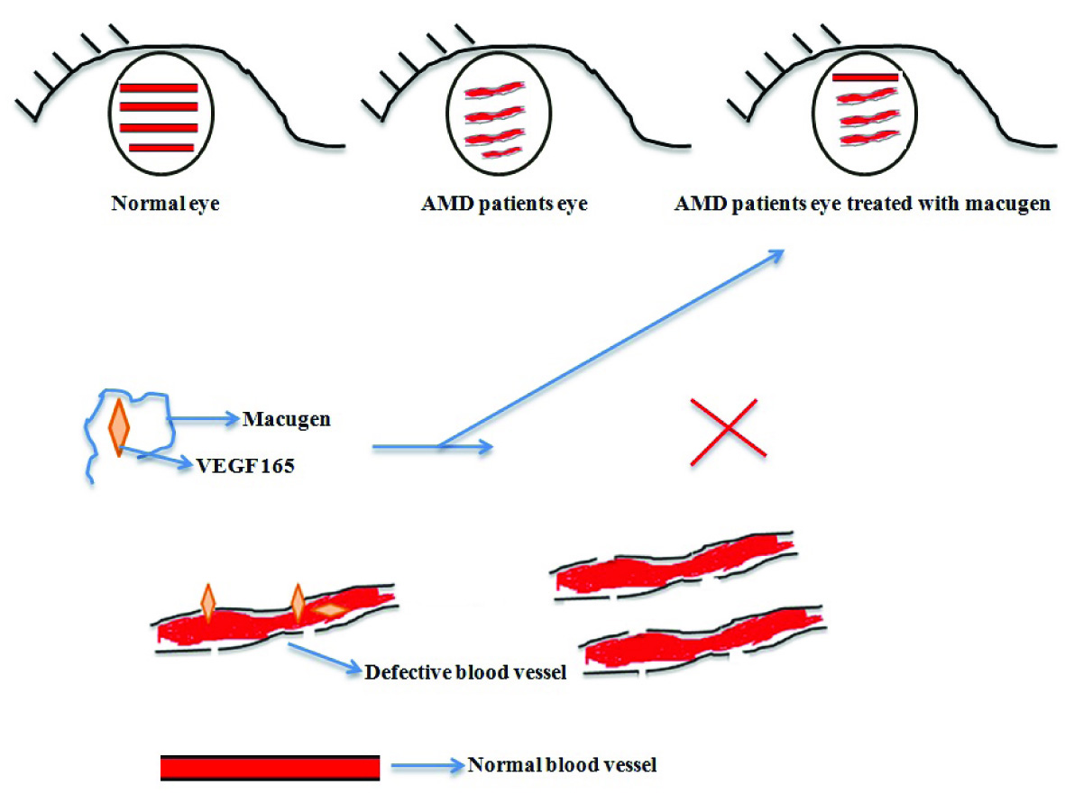 Macugen for AMD treatment.