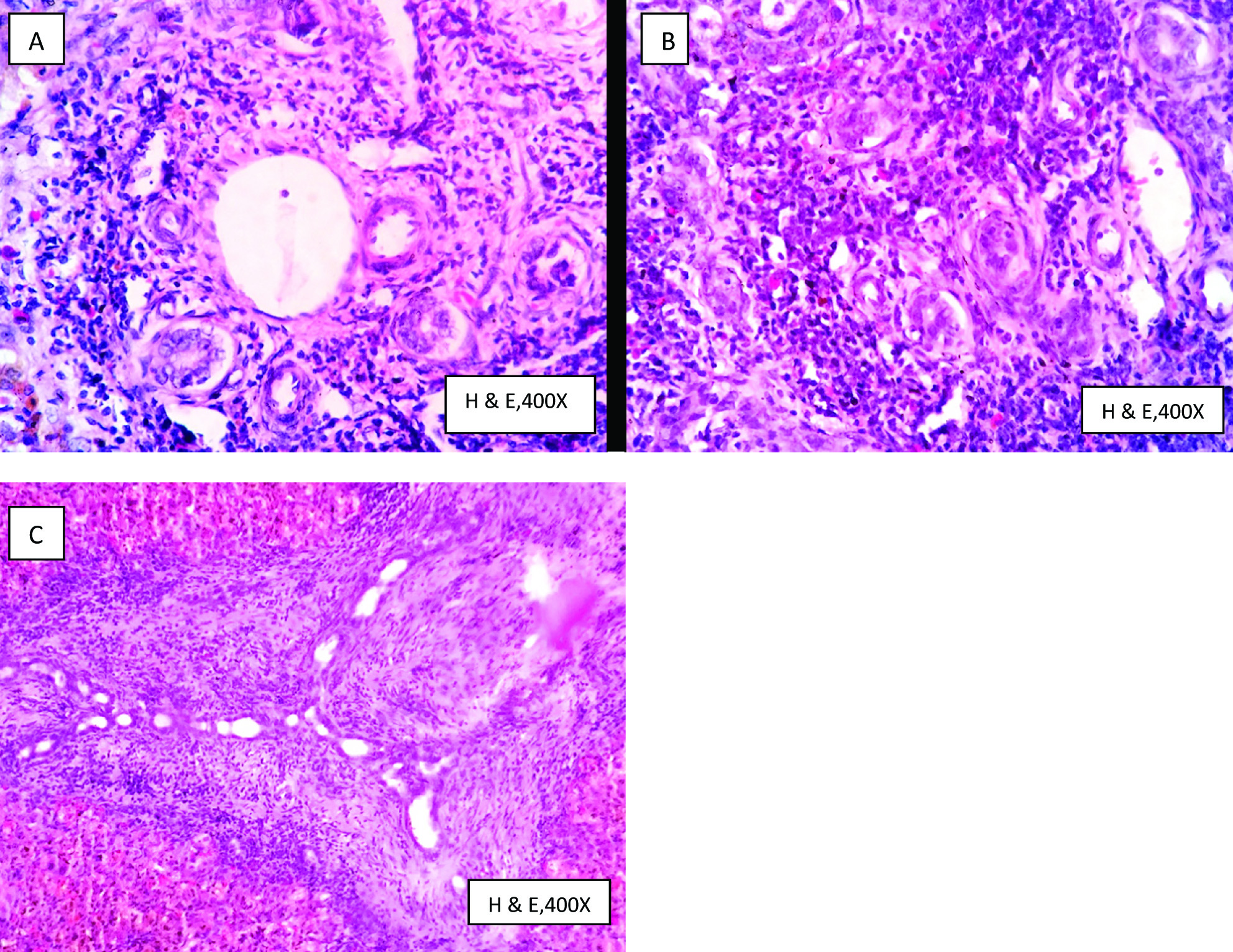 Common Bile Duct Histology
