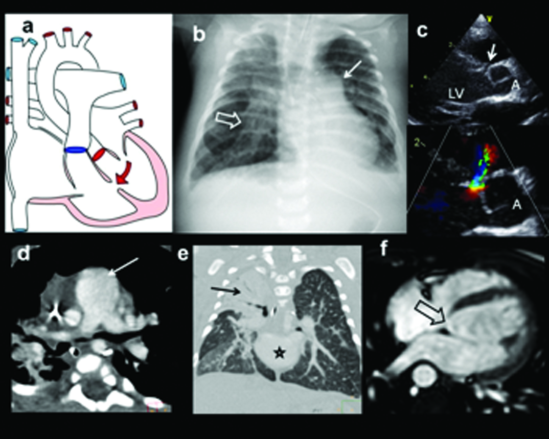 Plethora Cardiology