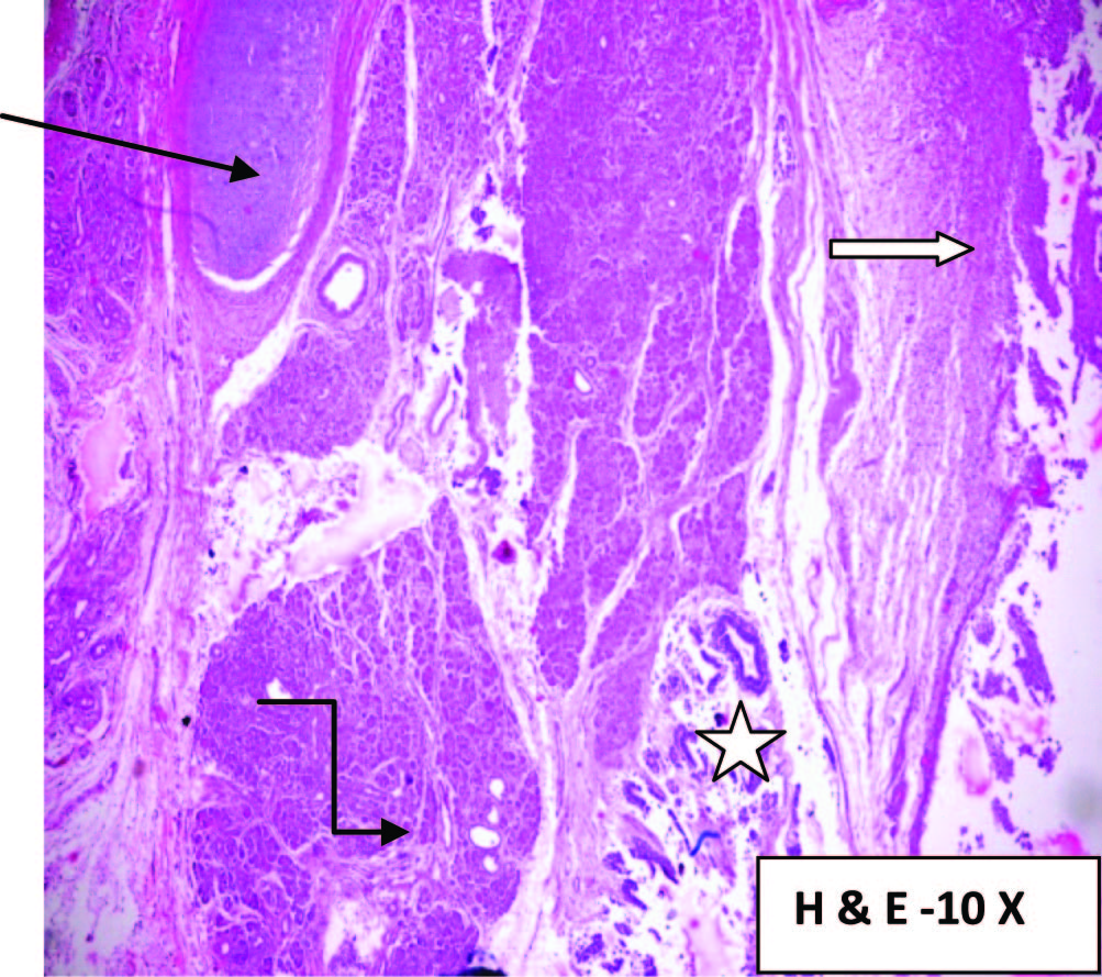Oral Histology Digital Lab Glands Secretory Acini Image 1
