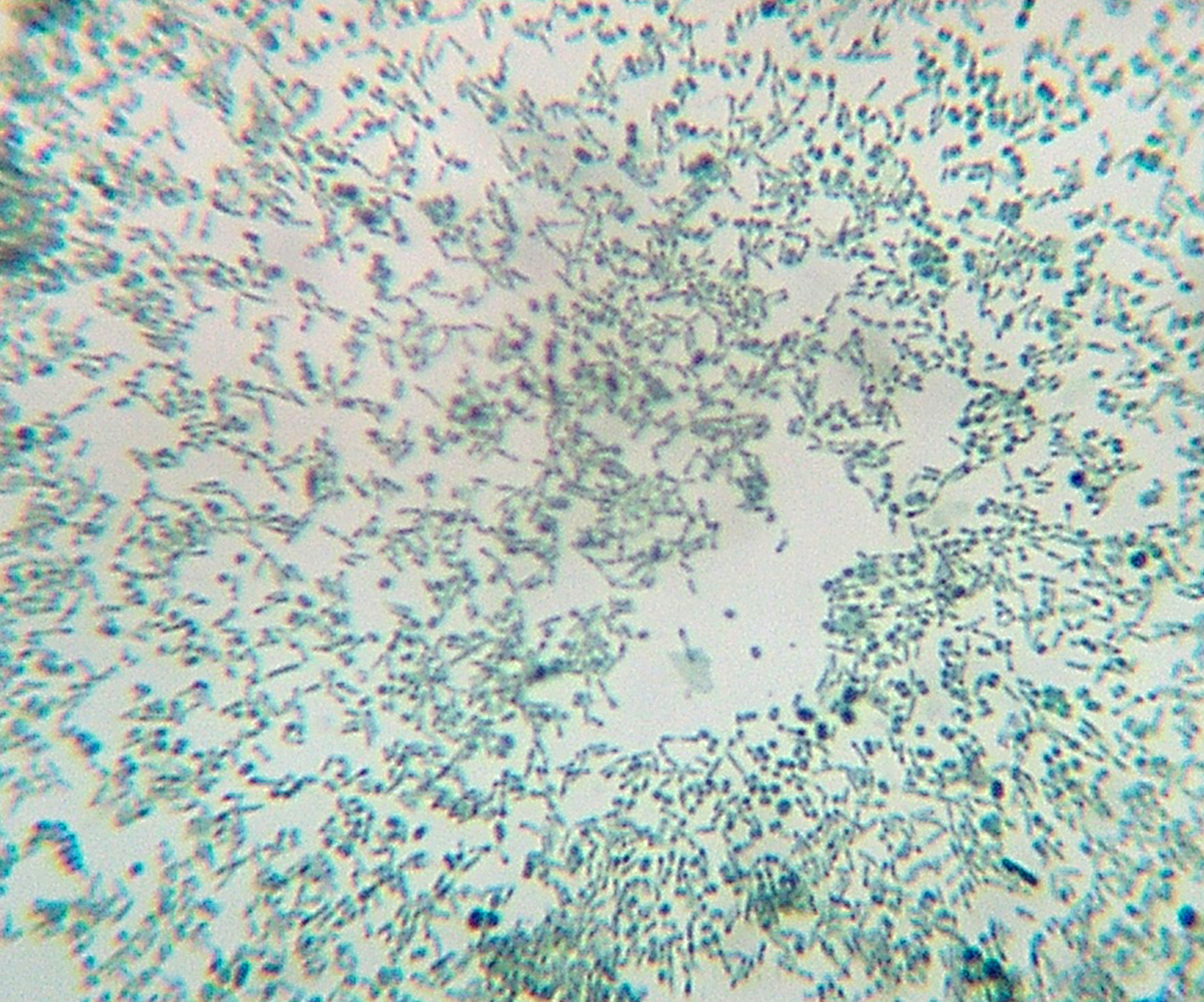 Corynebacterium Diphtheriae Albert Stain