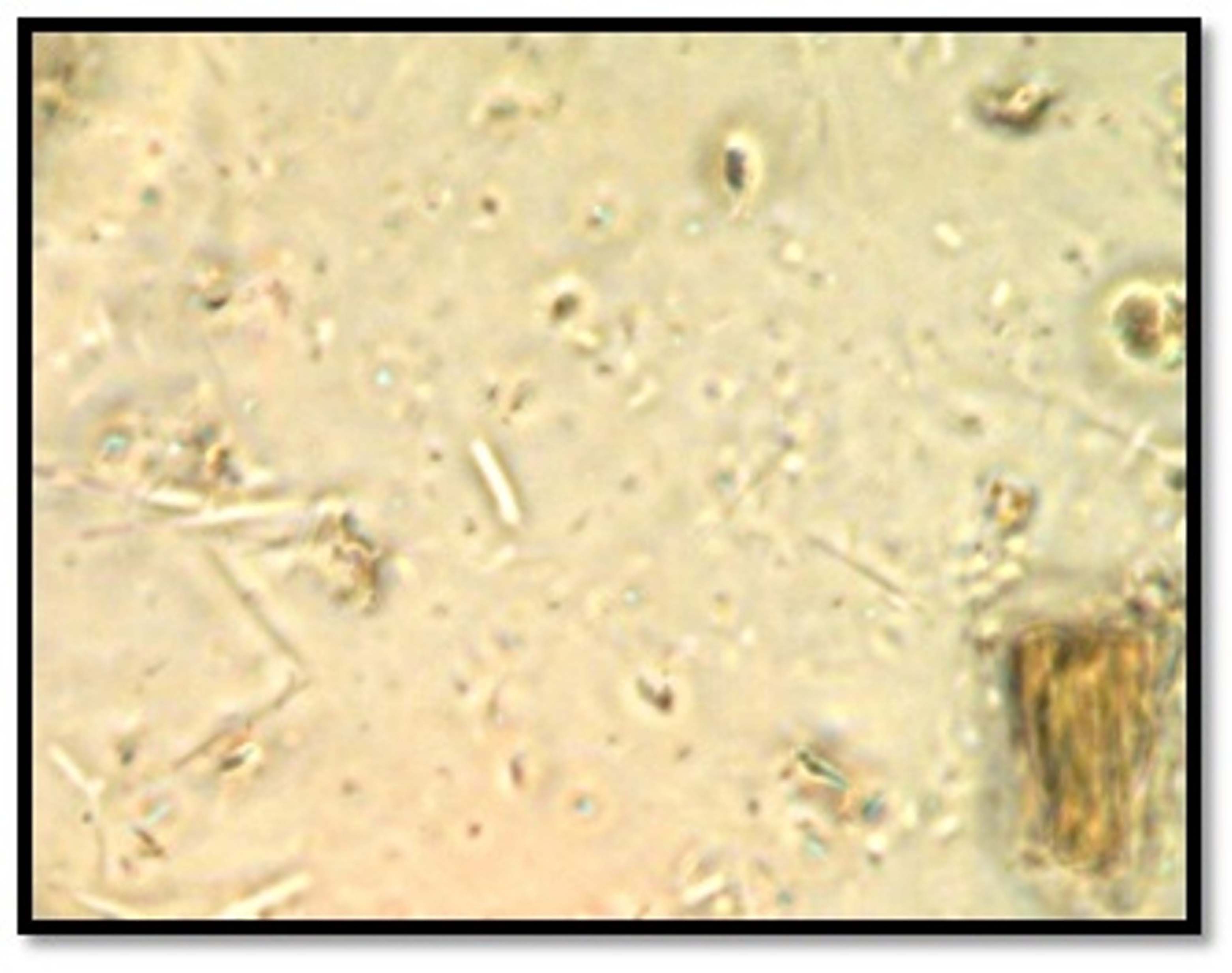 Dark Field Microscopy Bacteria