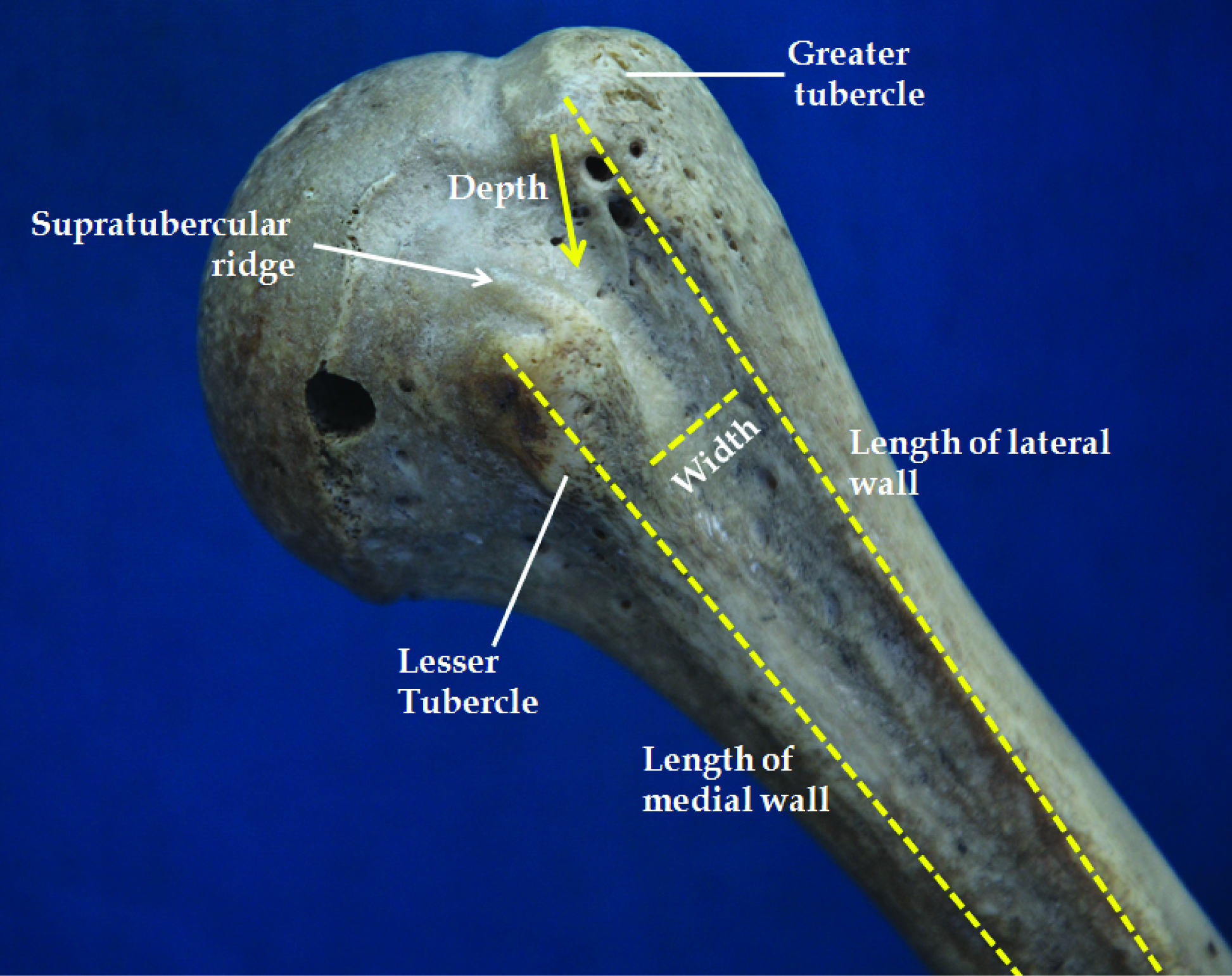 Medial Bicipital Groove