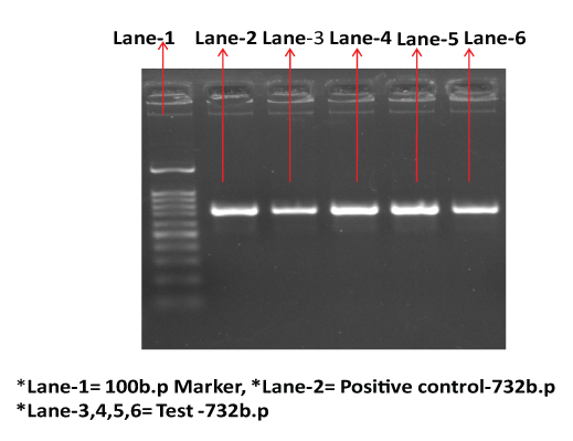 Detection of vancomycin resistant gene vanA by PCR (732 b.p).