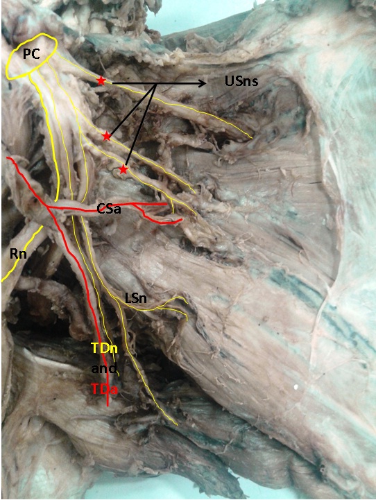 Dorsal Scapular Nerve Cadaver INNERVATION: BRACHIAL PLEXUS | Brachial,