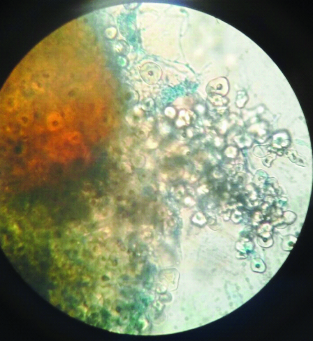 Log in the steam appearance of Candida pseudotropicalis on cornmeal agar.
