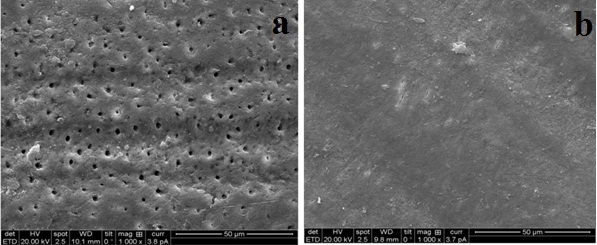 (a) Pre-treatment SEM picture of group C; (b) Post-treatment SEM ...