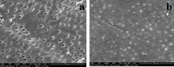 (a) Pre-treatment SEM picture of group D; (b) Post-treatment SEM ...