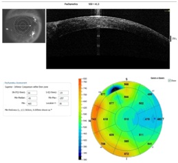Depicting pachymetry maps.