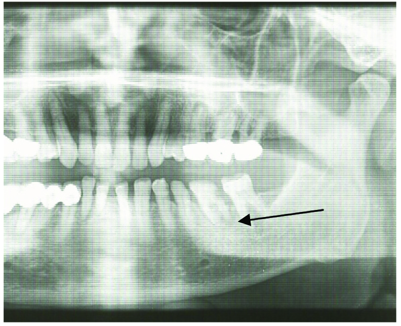[Table/Fig-1]: