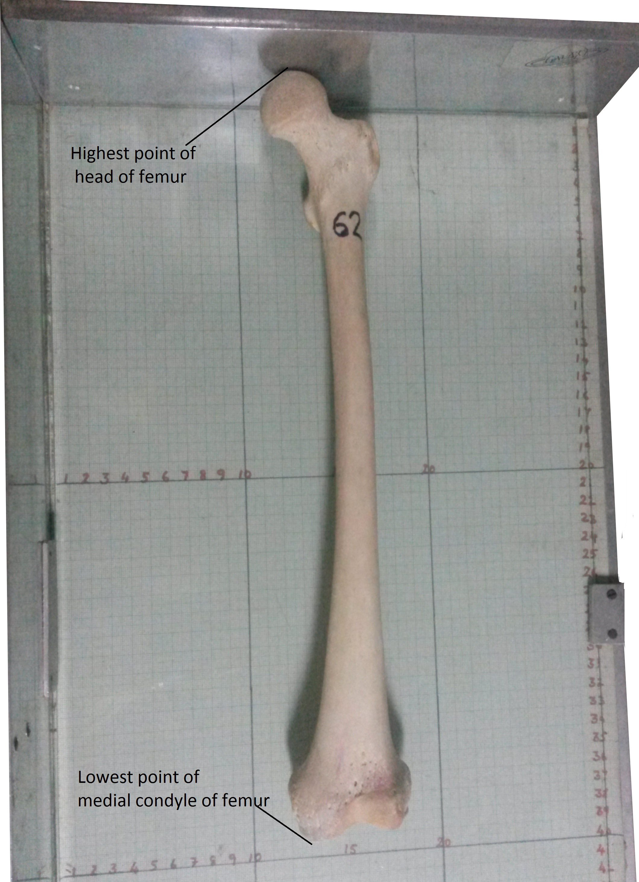 Diameter of femoral head in the craniocaudal axis.