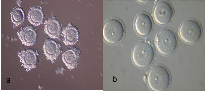 Invitro fertilization (IVF)
